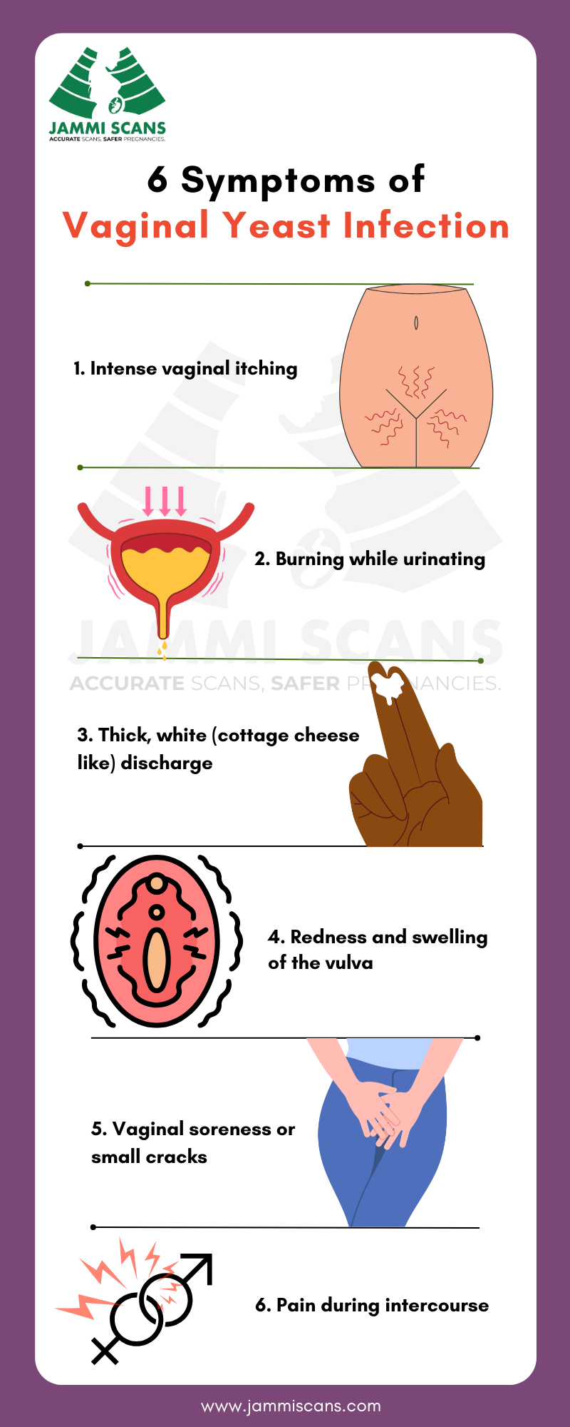 Vaginal Yeast Infection: Symptoms, Treatment, and Prevention