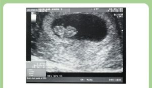 CRL in Pregnancy: How Crown Rump Length Predicts Baby's Growth?