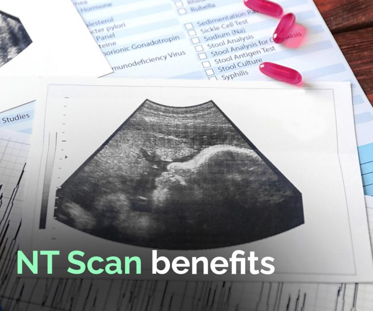 Unlocking The NT Scan Benefits: A Complete Guide for Pregnant Women in 2023