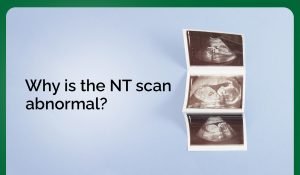 When the NT scan is not normal: A Comprehensive Overview in 2023