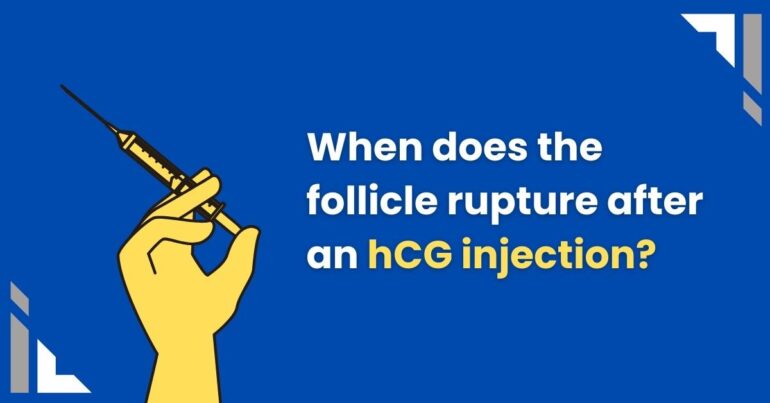 The Role of HCG Injection in Follicular Study: An Advanced Step-by-Step ...