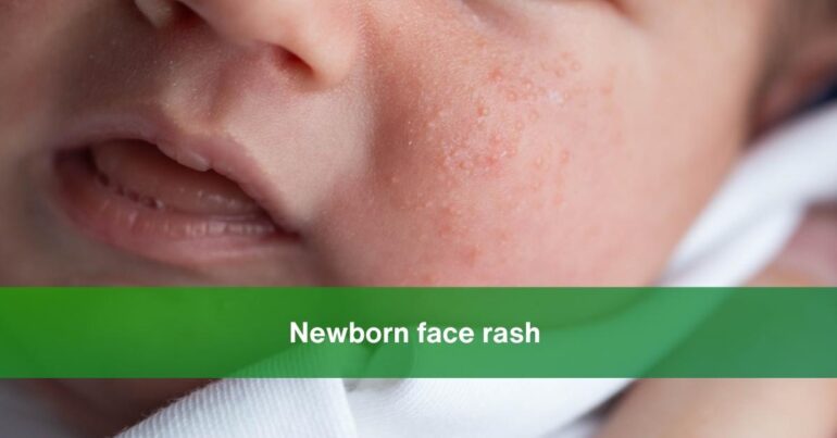 Worried About Your Newborn Face Rash? Discover 6 Causes and Solutions