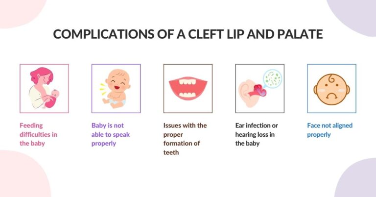 Cleft Lip and Palate Awareness: Causes, Symptoms and Risk Factors 2024