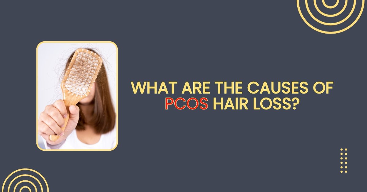 Understanding PCOS Hair Loss: Symptoms, Causes, and 4 Proven Remedies