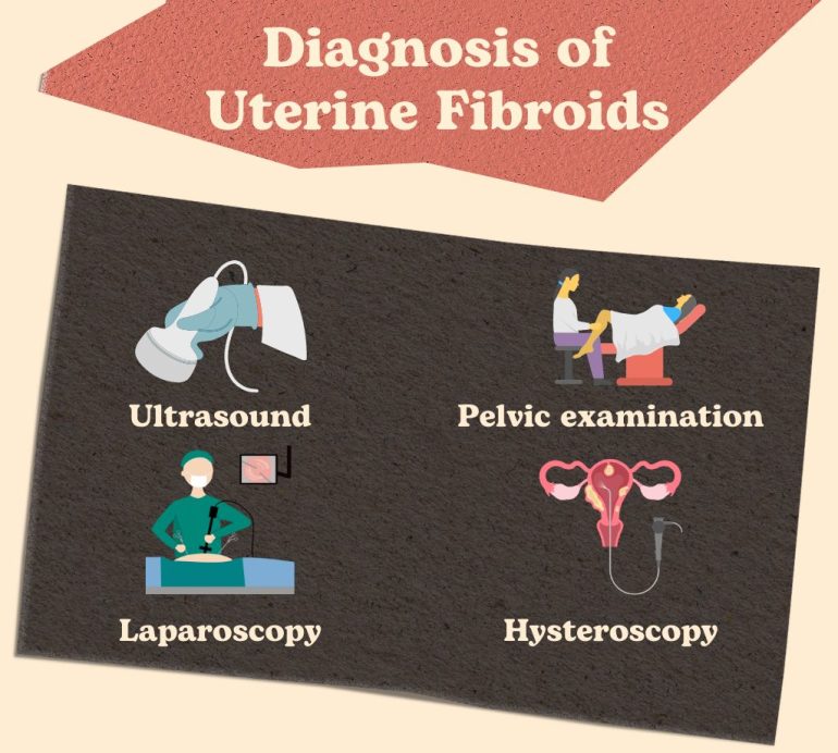Uterine Fibroids: Causes, Symptoms, and Treatment - A Comprehensive ...