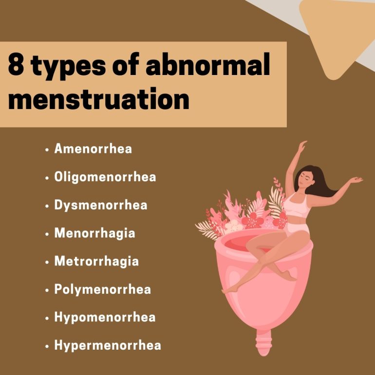 Understanding the 10 Causes of Irregular Periods: A Comprehensive Guide